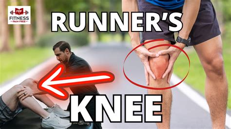 Patellofemoral Pain Evidence Based Treatments Physio Guide