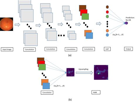 Diabetic Retinopathy Detection Via Deep Convolutional Networks For Discriminative Localization