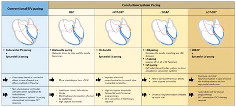 Conduction System Pacing Versus Conventional Biventricular Pacing For