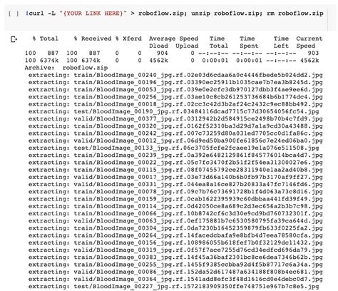 How To Train Detectron2 On Custom Object Detection Data