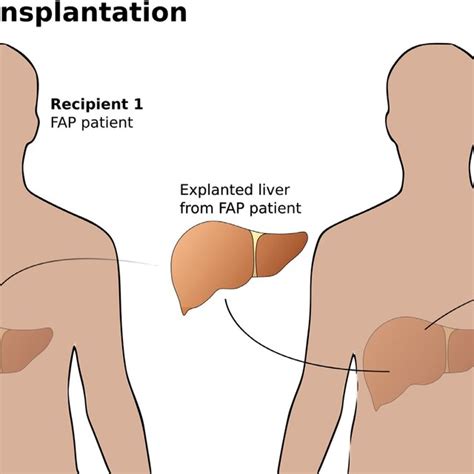 Survival Rate Of Different Patient Groups After Liver Transplantation Download Scientific