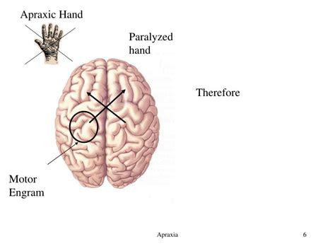 Ppt Apraxia Powerpoint Presentation Free Download Id363535