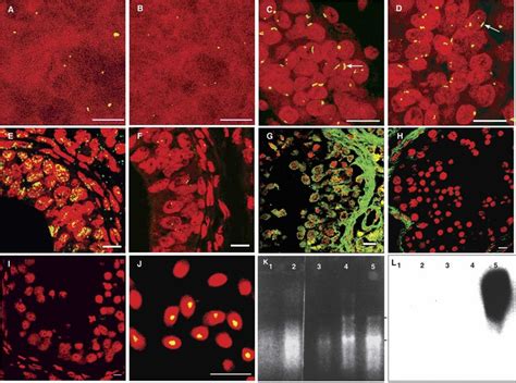 Developmental Stage Specific Decondensation And Expression From Human Download Scientific