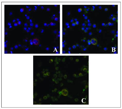 Fluorescent Microscopic Images Showing Colocalization Of Lysosomal Download Scientific Diagram