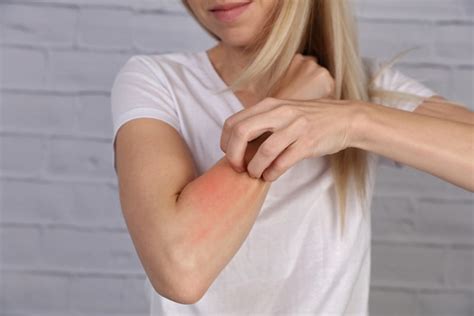 What Is That Rash Max Fitness Hub