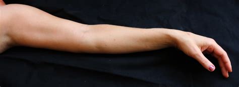 Arm Reference