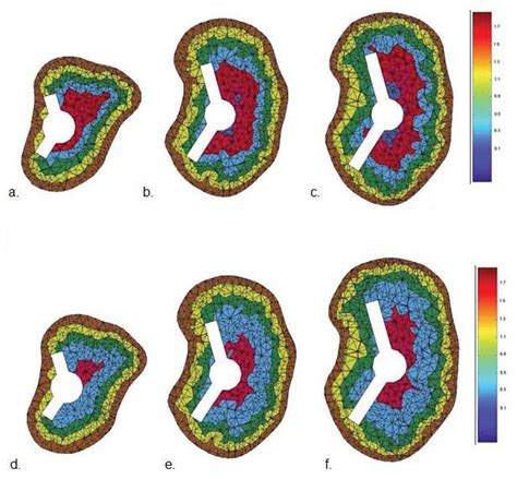 Series Of Sections Of The Prosthesis Tibial Epiphysis With Bone