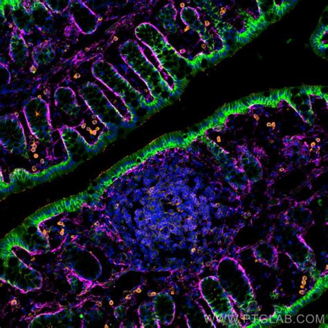 E Cadherin Antibody 20874 1 Ap Proteintech