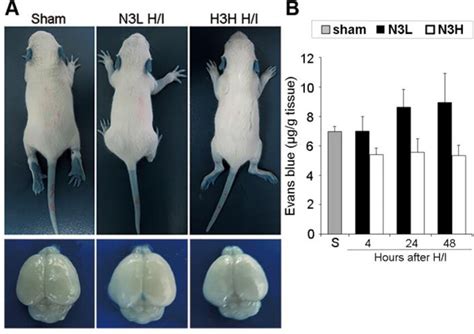 Lack Of Intracranial Extravasation Of Evans Blue After Hi Injury In