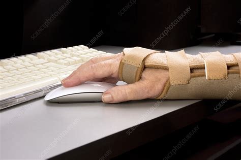 Mouse And Wrist Brace Stock Image C022 9430 Science Photo Library