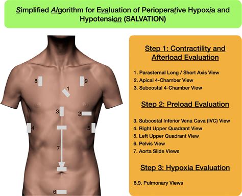 Simplified Algorithm For Evaluation Of Perioperative Hypoxia And