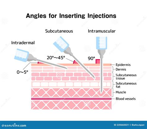 Angles For Inserting Injections Vector Illustration 220660031