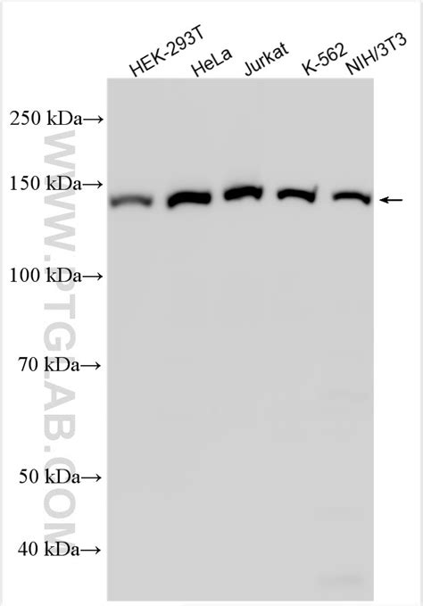Pfas Antibody 24716 1 Ap Proteintech