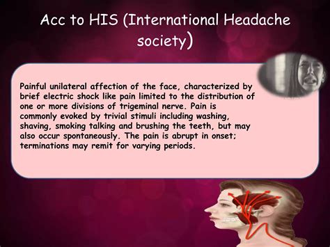 Symptomatology And Pathophysiology Of Trigeminal Neuralgia Copy Pptx