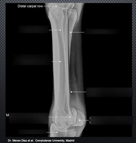 Metacarpus Diagram Quizlet