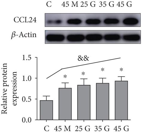 Ccl24 Is A Potential Protective Factor For Diabetic Nephropathy By