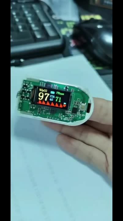 Lily Zhang On Linkedin Pcb Pcbassembly 13 Comments