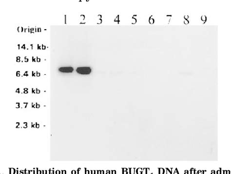 Figure 1 From Long Term Correction Of Bilirubin Udp