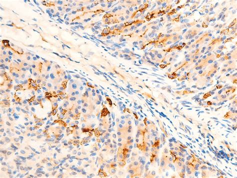 Anti Sgk1 Sgk Antibody Rabbit Anti Human Polyclonal Lsbio