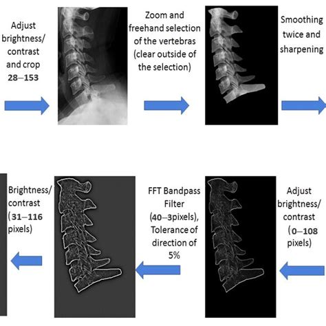 Features Extraction Using The Glcm Method Applied To The Necks X Ray Download Scientific