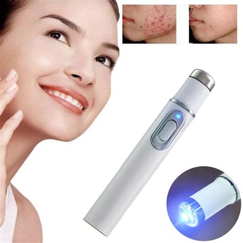 Blue Light Therapy Acne Pen — Gear Elevation