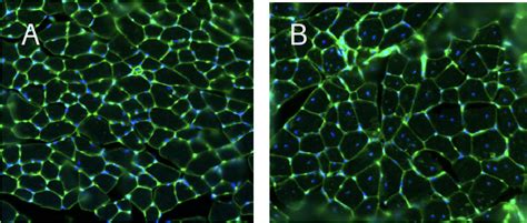 Mdx Mouse Model Validation Data Innoser Neurology Cro