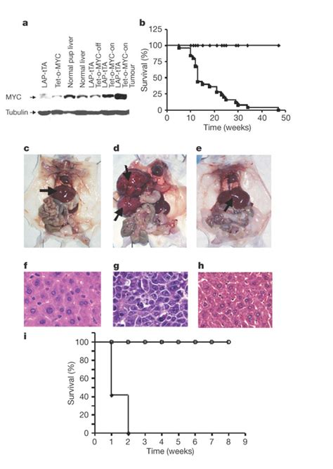 Conditional Myc Overexpression In The Liver Induces Hepatocellular Download Scientific Diagram