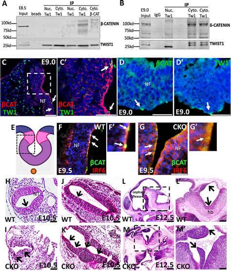 twist1 interaction with β δ catenin proteins a b the in vivo