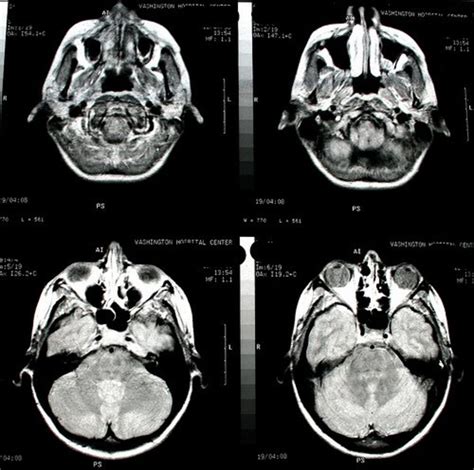 Male And Female Brains Similarities And Differences Hubpages