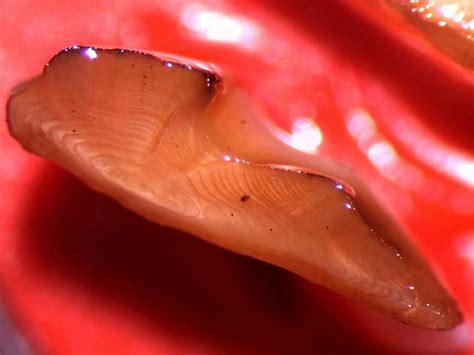 Walleye Otolith R Microscopy