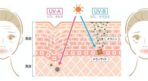紫外線 Uvaとuvb 肌の断面図 女性イラスト No 24142033｜無料イラスト・フリー素材なら「イラストac」