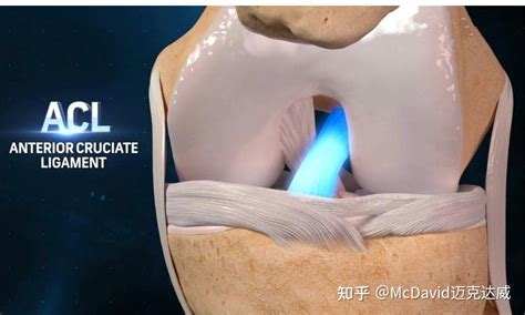 足球场的 杀人诛心”——前十字韧带损伤 知乎