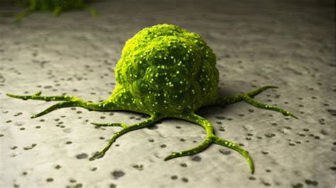 سرطان غدد لنفاوی علت ها علائم و درمان