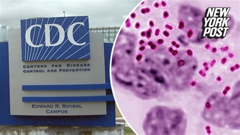 CDC Recommends Morning After Pill To Fight STIs In Gay Transgender Populations News Com Au