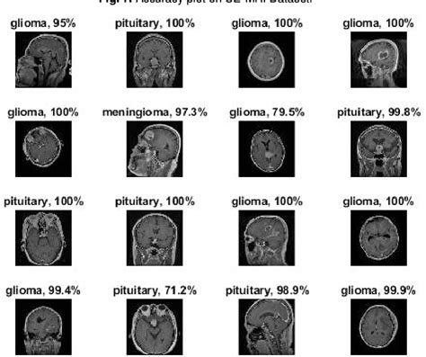 Figure 8 From Multi Tumor Classification In Mr Brain Images Through Deep Feature Extraction
