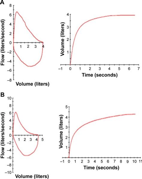 Spirometry Showing Normal A And Obstructive B Patterns Download