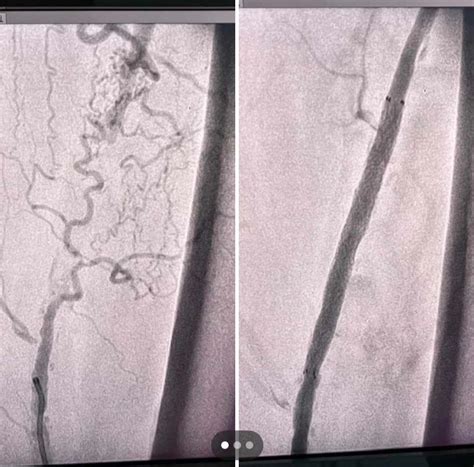 Dr Bassem Jerbi On Linkedin Sfa