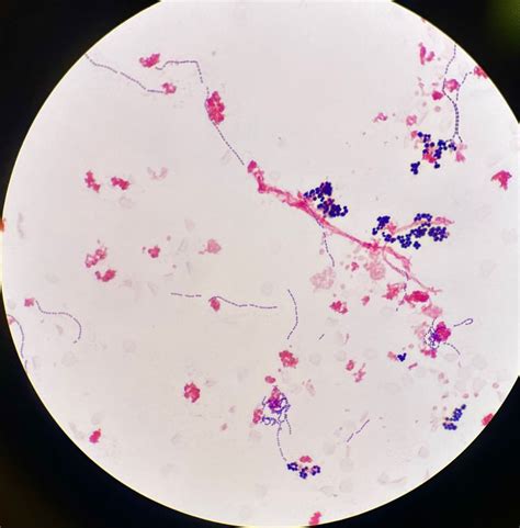 Christine F On Linkedin Underthemicroscope Microbiology Staphylococcus Streptococcus…