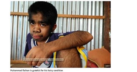 13 годишно момче страдащо от рядко генетично заболяване става божество