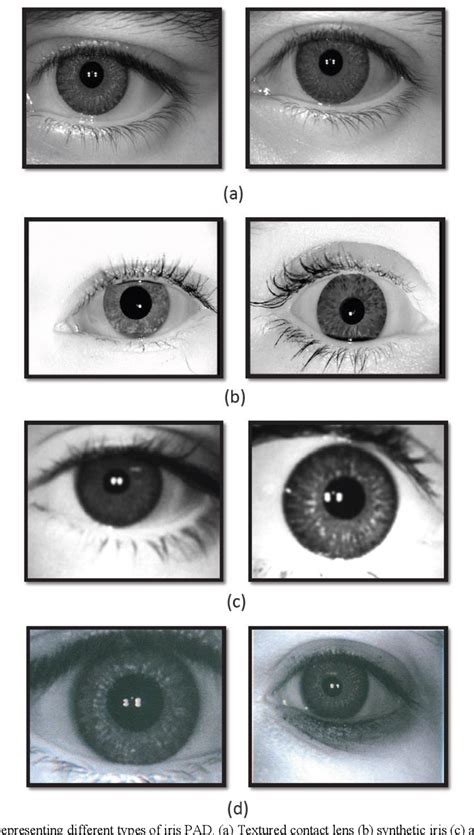 Figure 1 From A Comprehensive Survey On Iris Presentation Attacks And Detection Based On