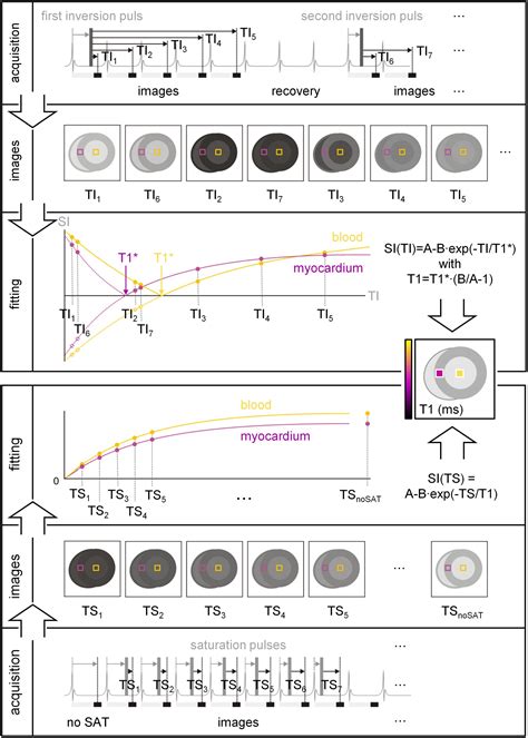 Cardiac Magnetic Resonance T1 Mapping Part 1 Aspects Of Acquisition And Evaluation European
