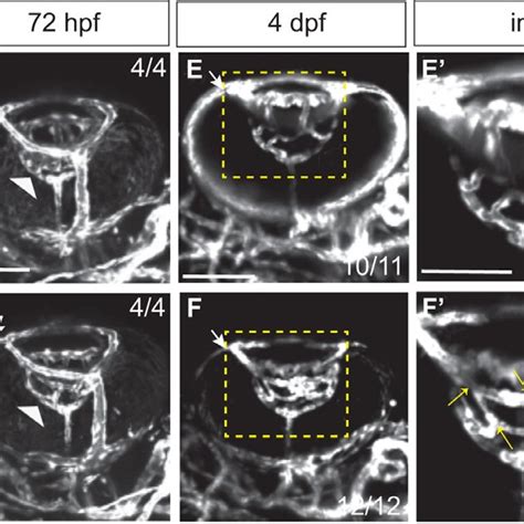 No Obvious Disruption Of The Rpe And Outer Limiting Membrane With The