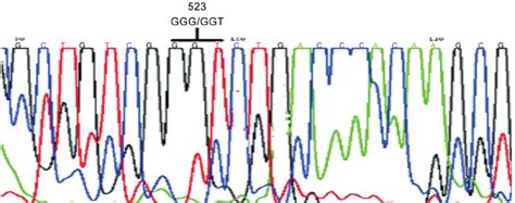Nine Different Polymerase Chain Reaction Single Strand Conformation Download Scientific Diagram