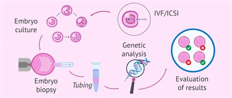 Process Of Pgd Preimplantational Genetic Diagnosis