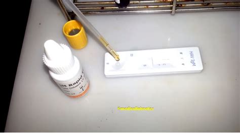 Immunochromatographic Test Ict Introduction Principle Test Requirements Procedure Result