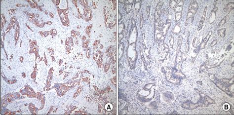 Immunohistochemical Staining Of The Surgical Specimen Download