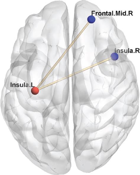 Rs Fc Differences Between Cpp And Ppp The Figure Shows Girls With Cpp
