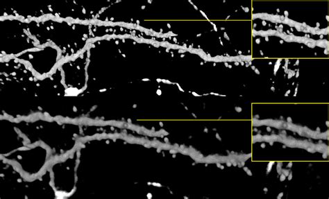 Ax R Mp With Nsparc Ax R Mp With Nsparc Confocal And Multiphoton