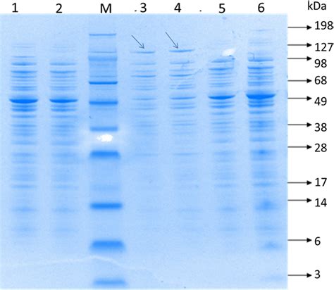 Cloning And Overexpression Of Bacillus Subtilis Pyruvate Carboxylase Download Scientific