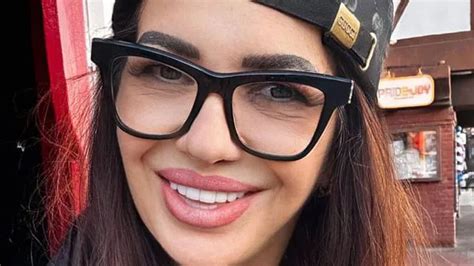 Анита Мейзер с тотален ремонт на лицето